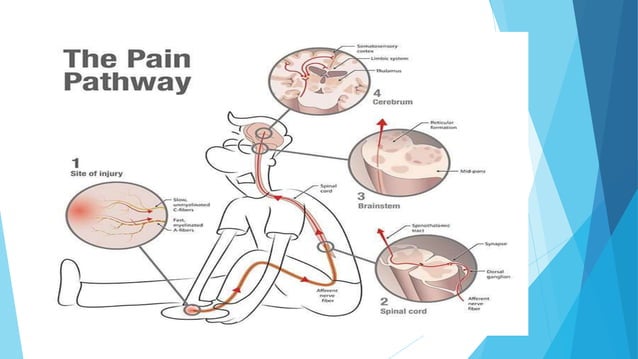 Pathway , physiology , perception of pain | PPTX