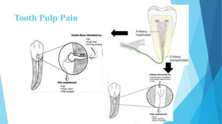 Pathway , physiology , perception of pain | PPTX