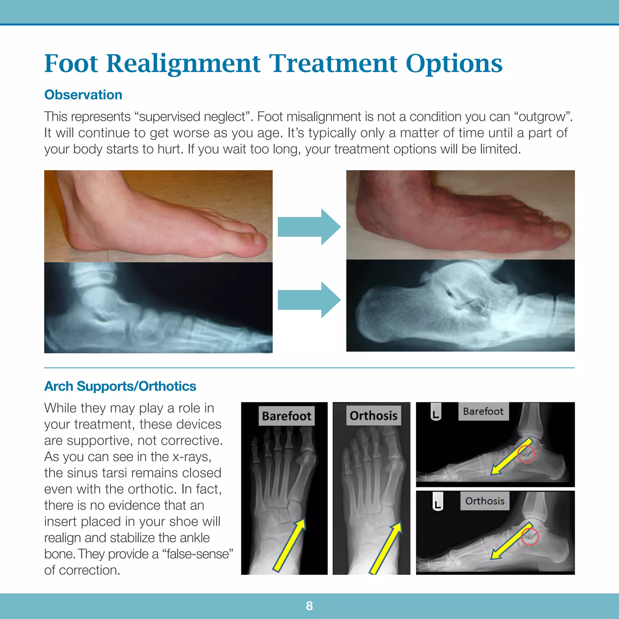 Patient's Guide to HyProCure - Minimally Invasive Solution to ...