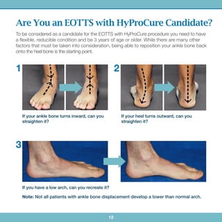 Patient's Guide to HyProCure - Minimally Invasive Solution to ...