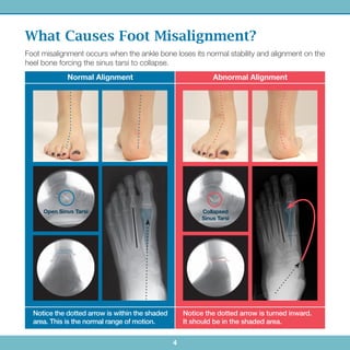 Patient's Guide to HyProCure - Minimally Invasive Solution to ...