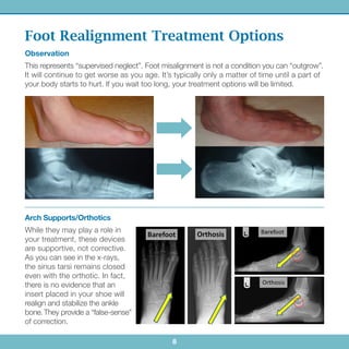 Patient's Guide to HyProCure - Minimally Invasive Solution to ...