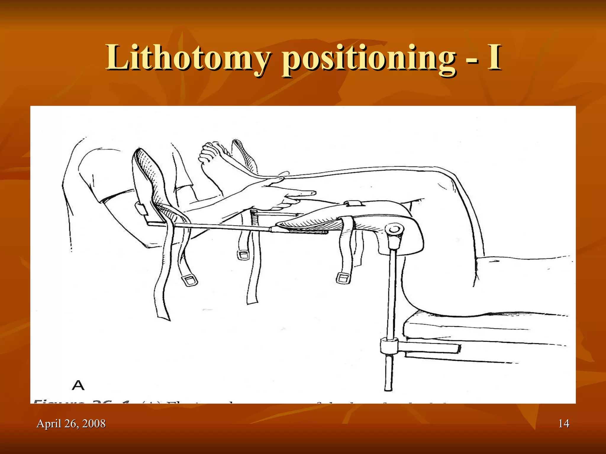 Patient Positioning | PPT