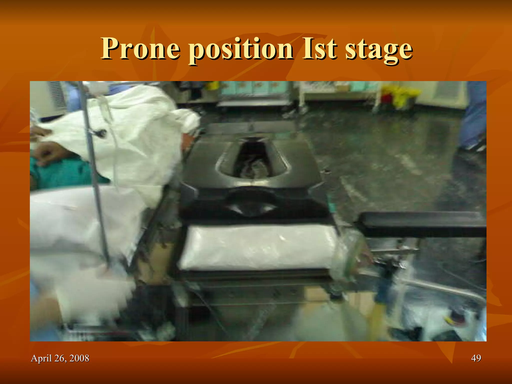 Patient Positioning | PPT