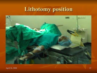 Dorsal Lithotomy Position
