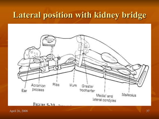 Lateral Kidney Position