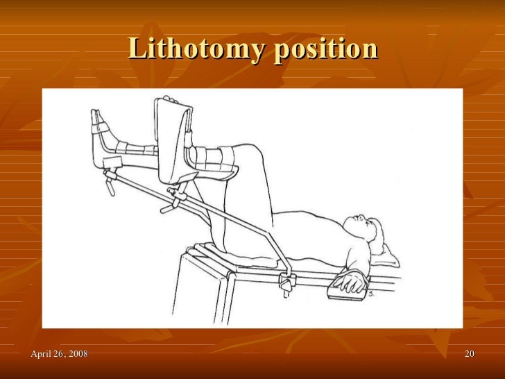 Patient Positioning