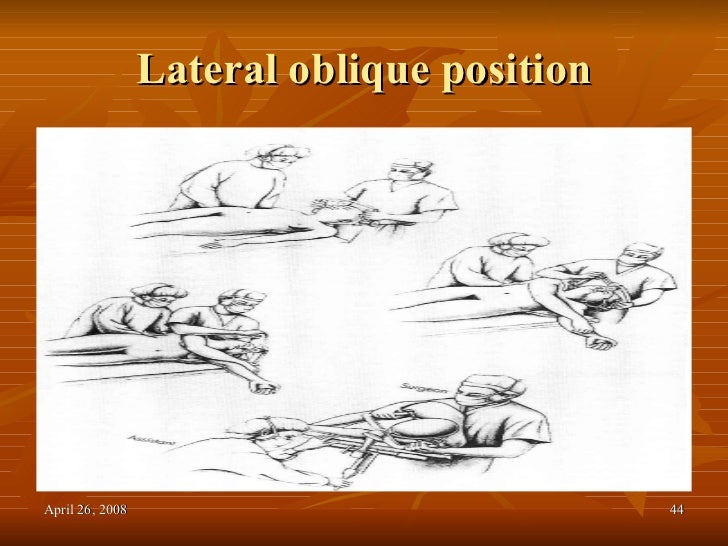 Lateral recumbent position - apocharge