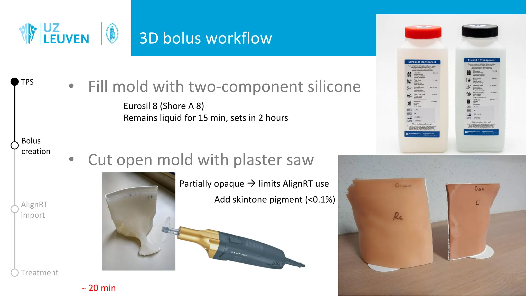Patient-specific bolus positioning with AlignRT | PDF