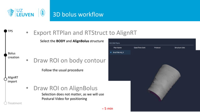 Patient-specific bolus positioning with AlignRT | PDF | Medical Health