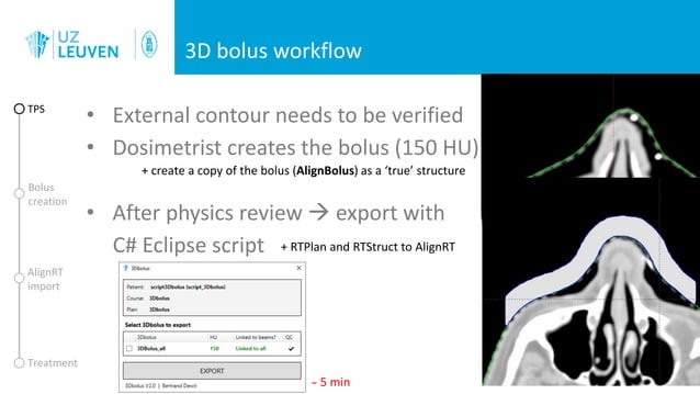 Patient-specific bolus positioning with AlignRT | PDF | Medical Health