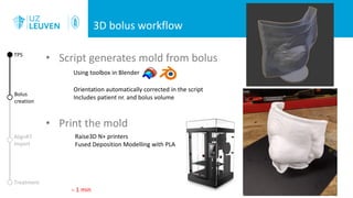 Patient-specific bolus positioning with AlignRT | PDF