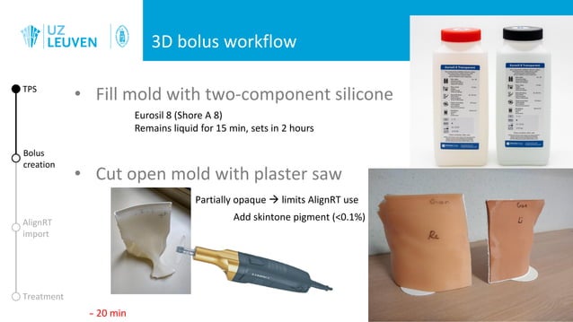 Patient-specific bolus positioning with AlignRT | PDF | Medical Health