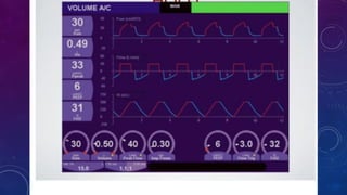 Patient ventilator interactions | PDF