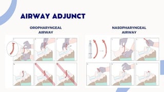 patient assessment (1).pdf | Air Travel | Travel Type