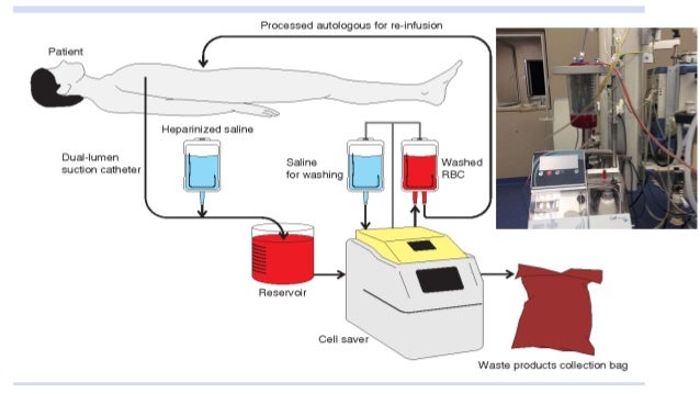 Patient blood management(1)