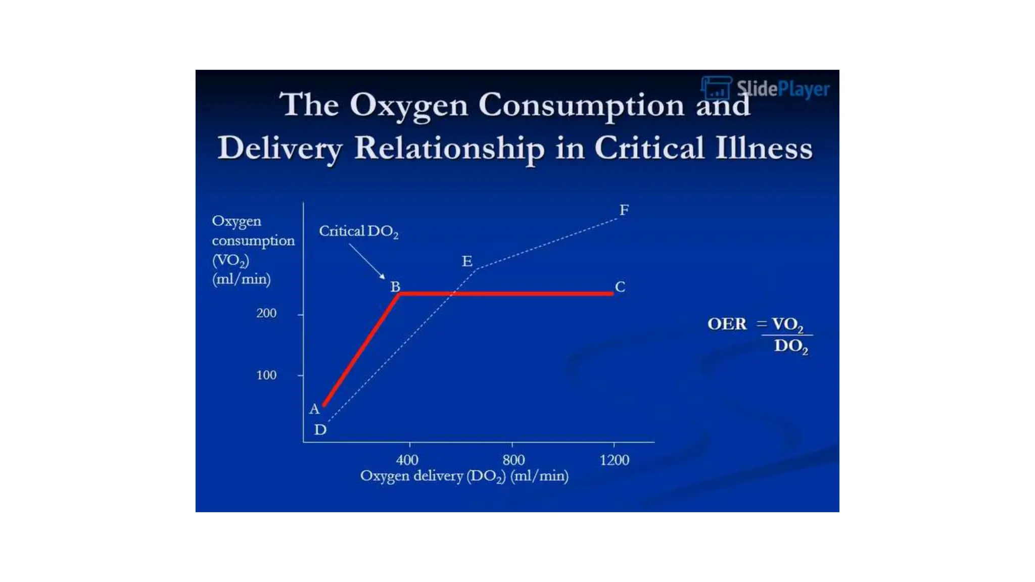Patient Blood Management in Critically Ill Patient | PPTX