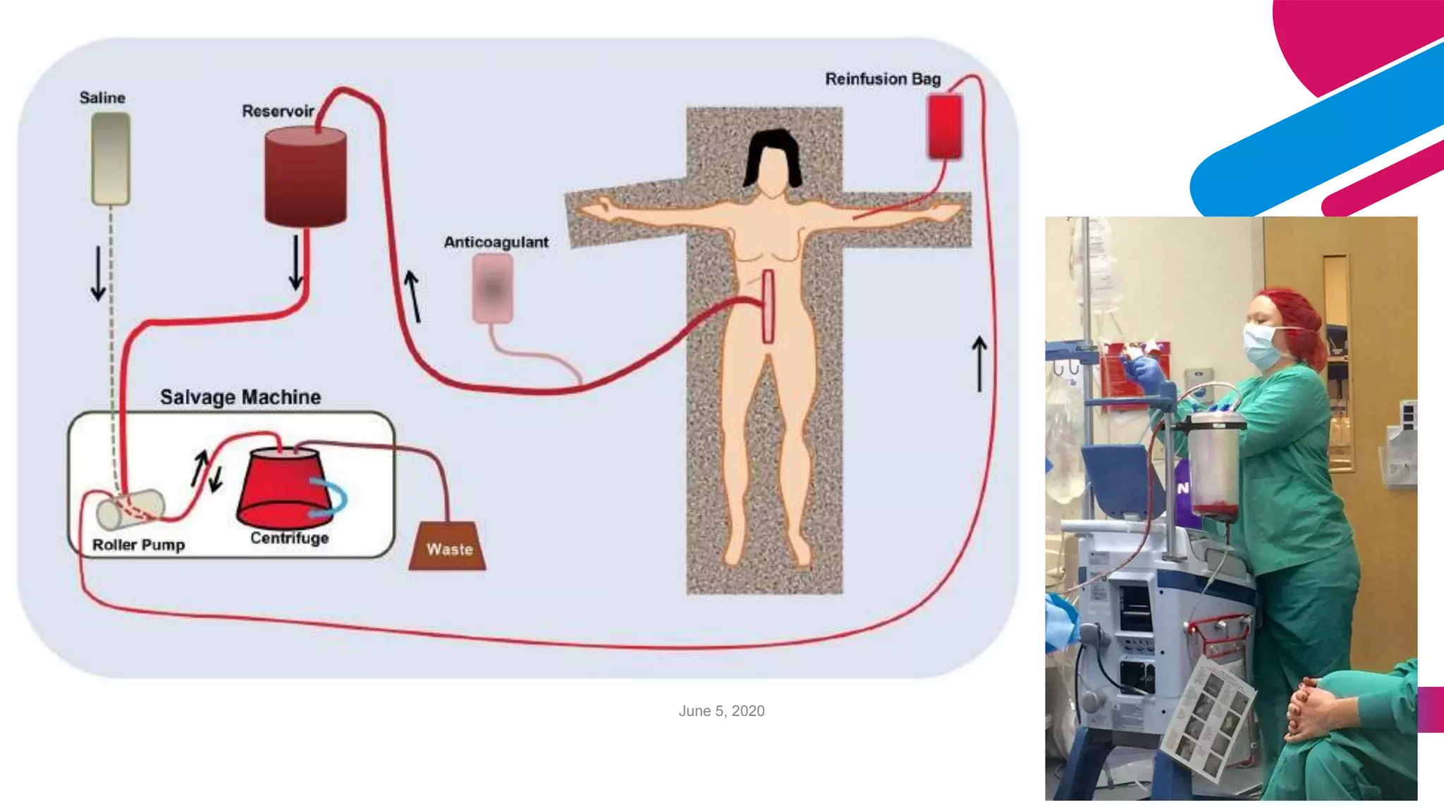 Patient blood management perioperative module | PPTX