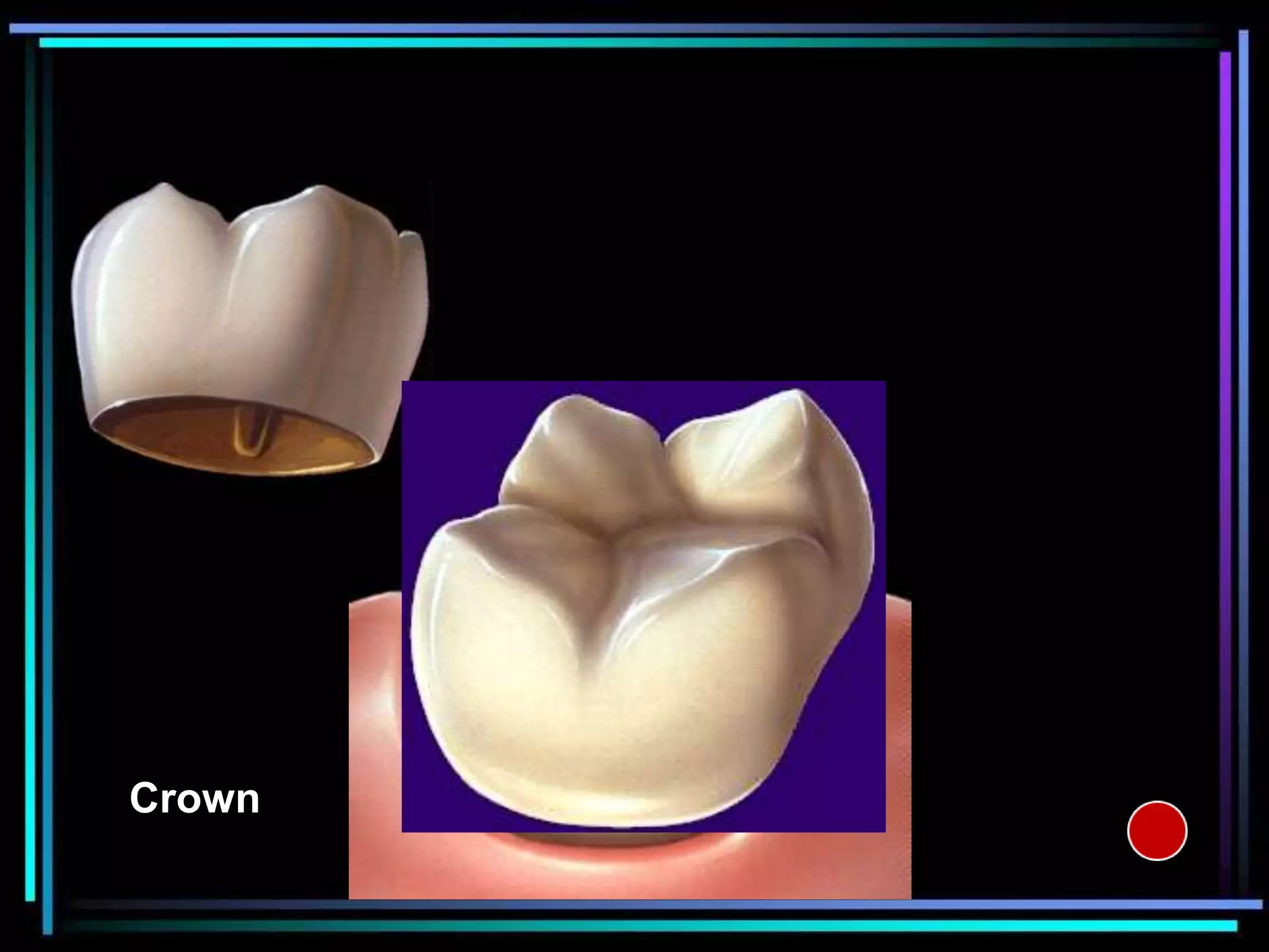 Dental Patient education Animations | PPSX