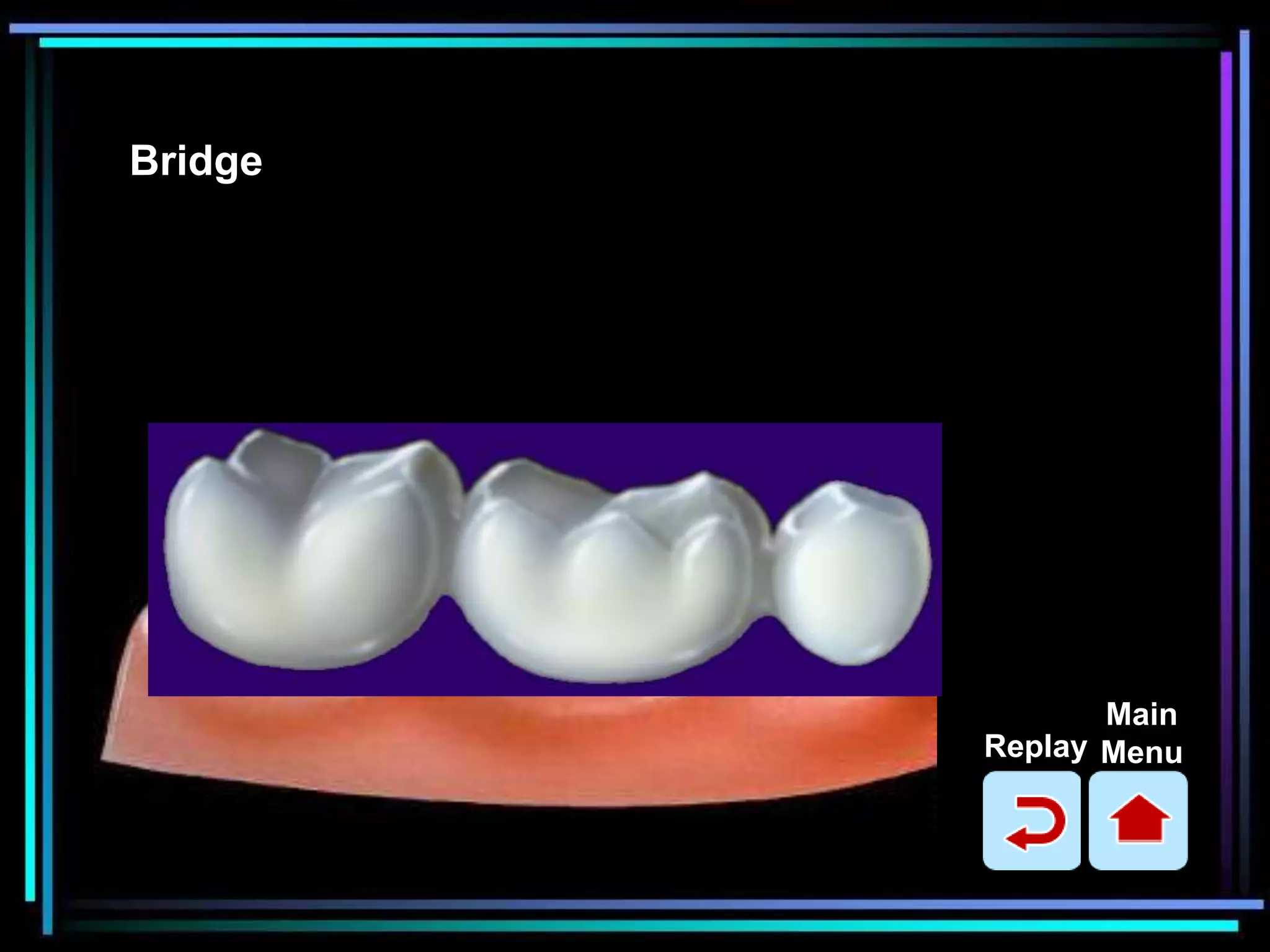 Dental Patient education Animations | PPSX