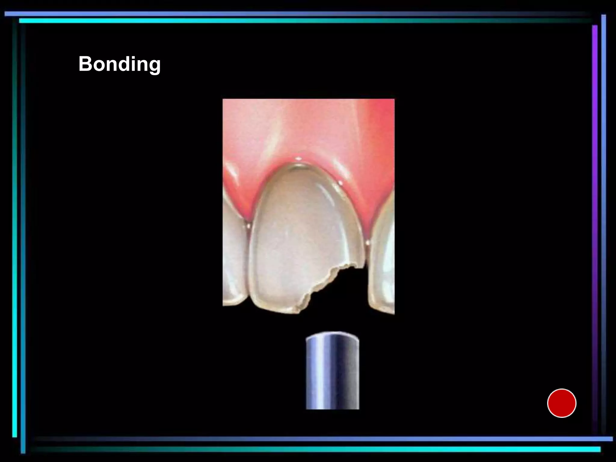 Dental Patient education Animations | PPSX