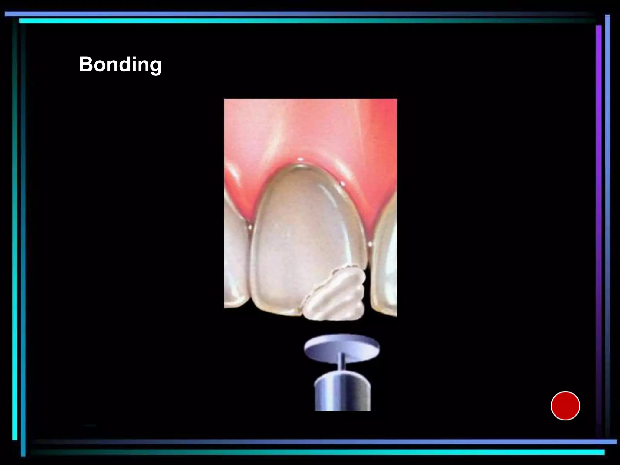 Dental Patient education Animations | PPSX
