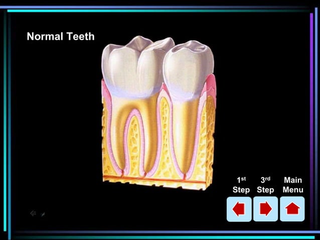 Dental Patient education Animations | PPSX | Dental Health | Diseases ...