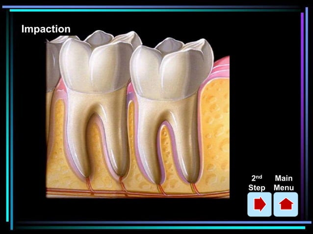 Dental Patient education Animations | PPSX | Dental Health | Diseases ...