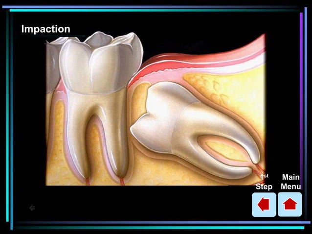 Dental Patient education Animations | PPSX | Dental Health | Diseases ...