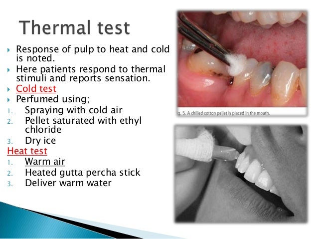 Patient evaluation,diagnosis and treatment planing in conservative