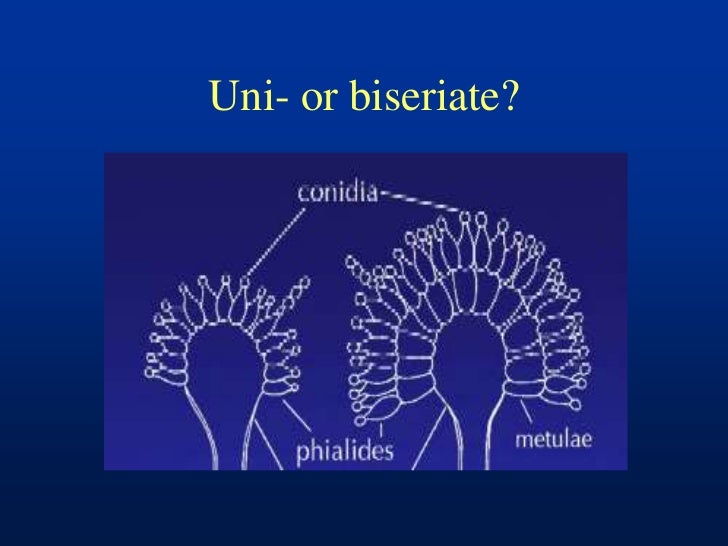 Aspergillosis Patient Support Meeting April 2011 - Nichola Duddy