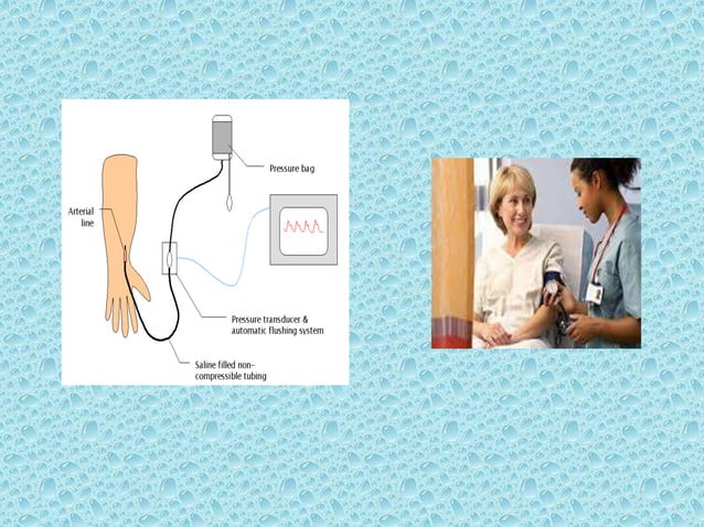 Patient monitoring system and biotelemetry | PPTX | Heart and ...