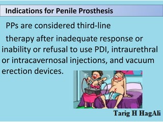 Patient & Partener Satisfaction after Penile Prosthesis Surgery | PDF