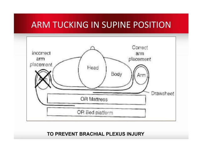 Patient positioning and associated risk | PPTX