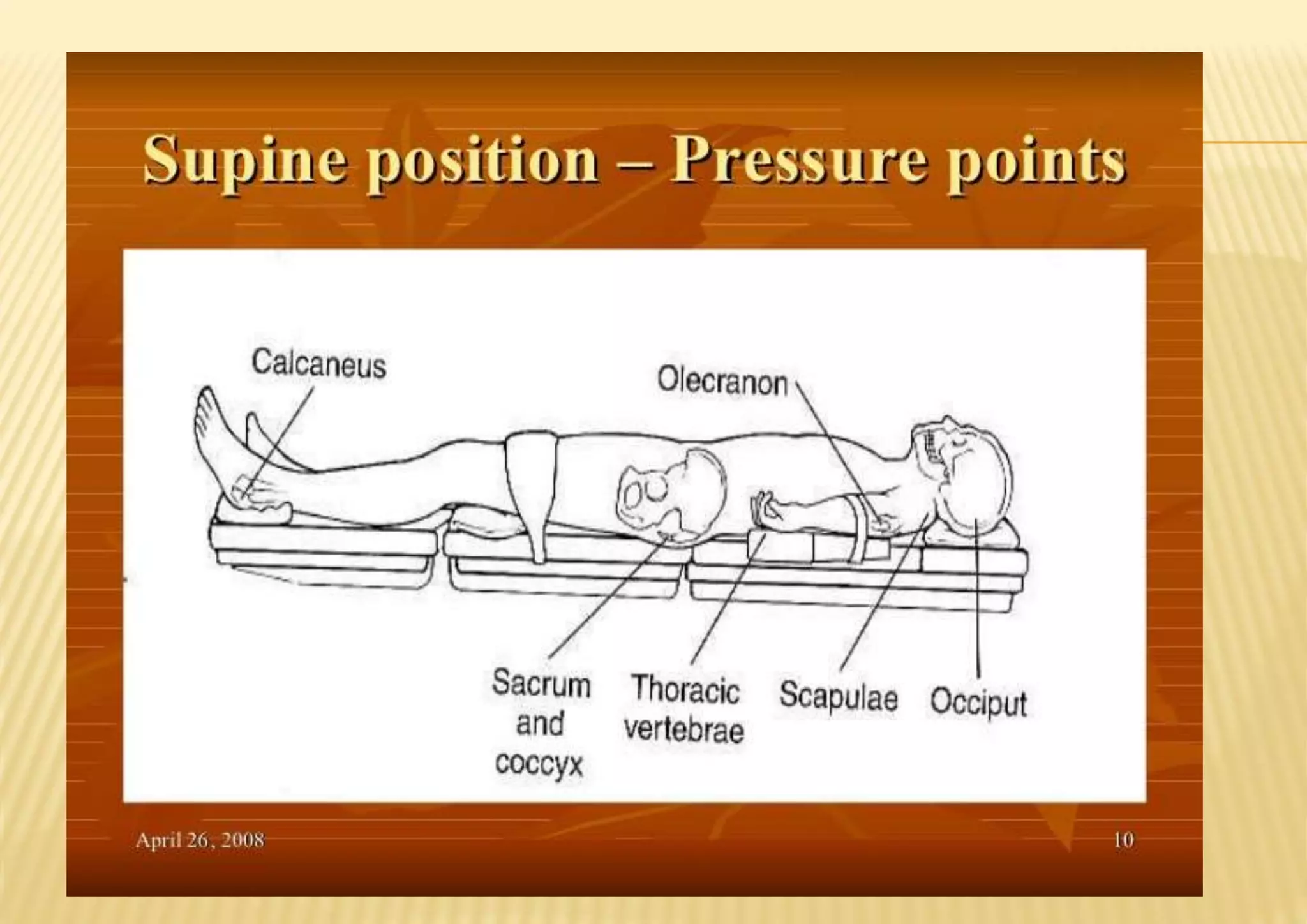 Patient position and anesthesia | PPTX