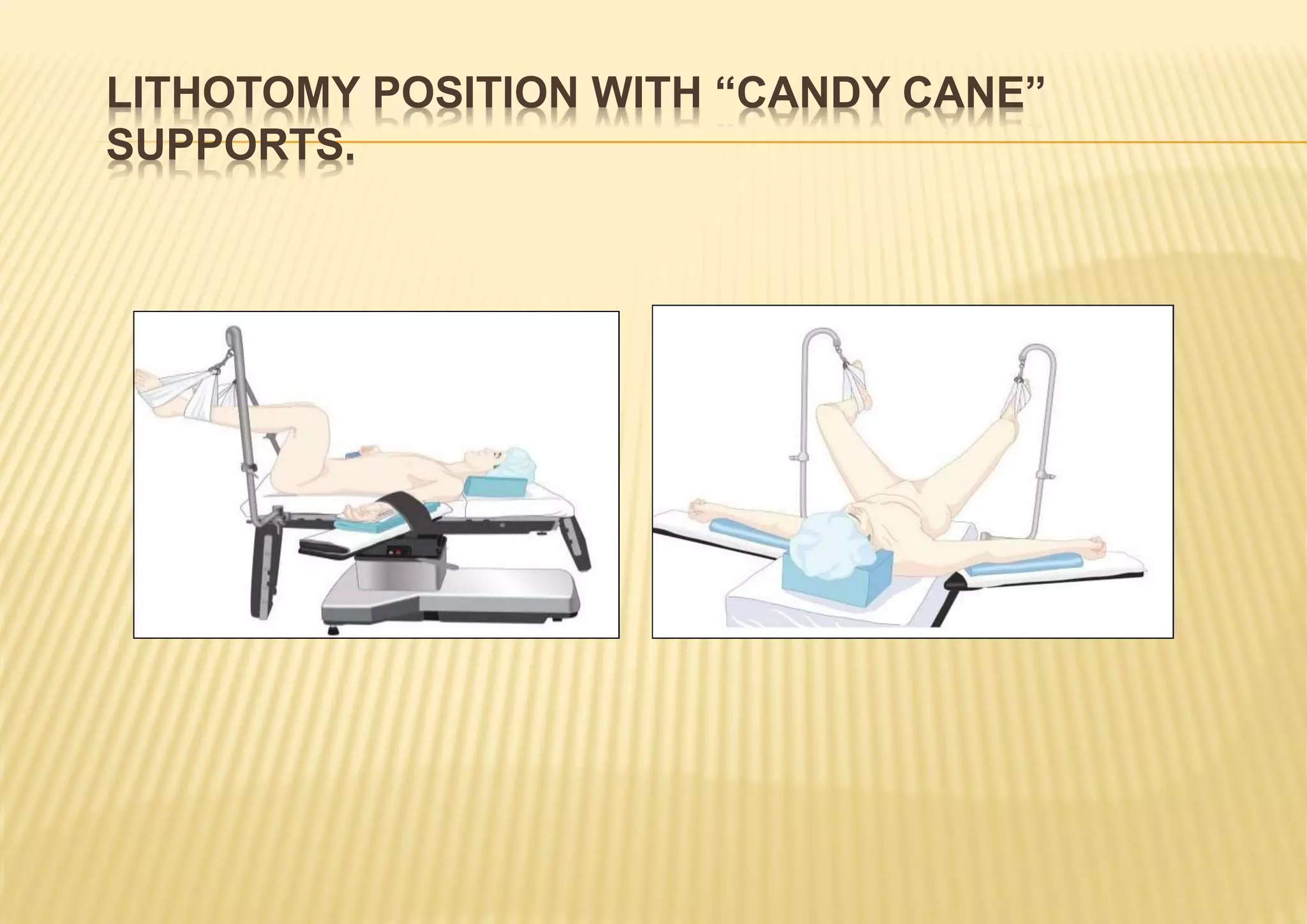 Patient position and anesthesia | PPTX