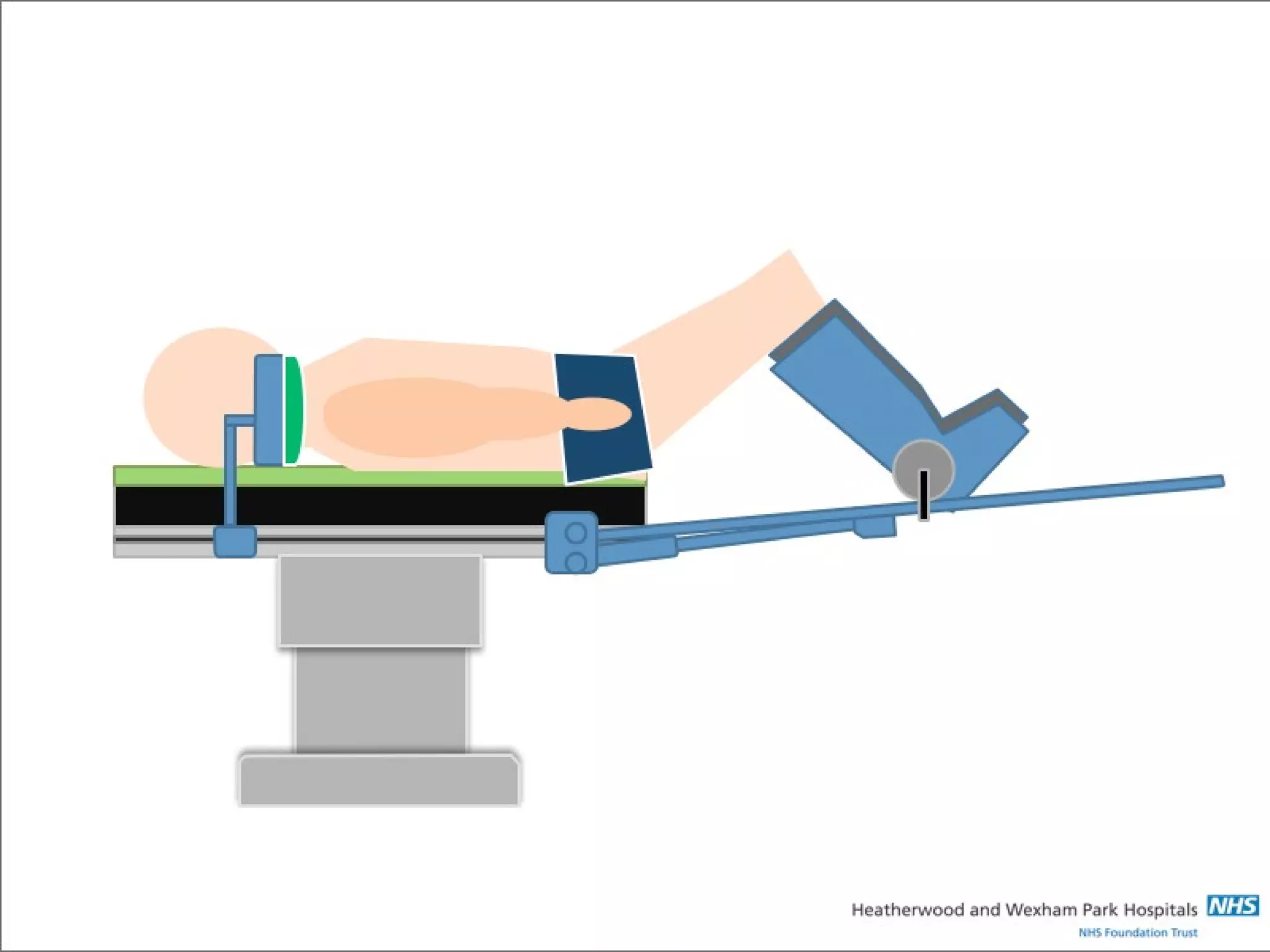 Patient positioning | PPT