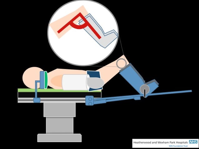 Patient positioning | PPT