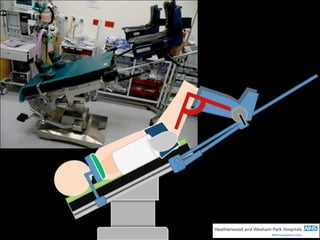 Patient positioning | PPT