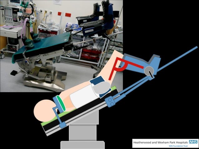 Patient positioning | PPT