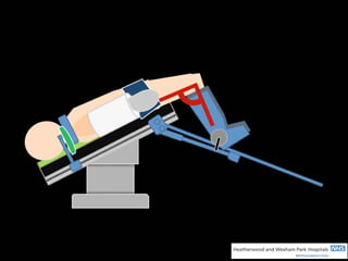 Patient positioning | PPT