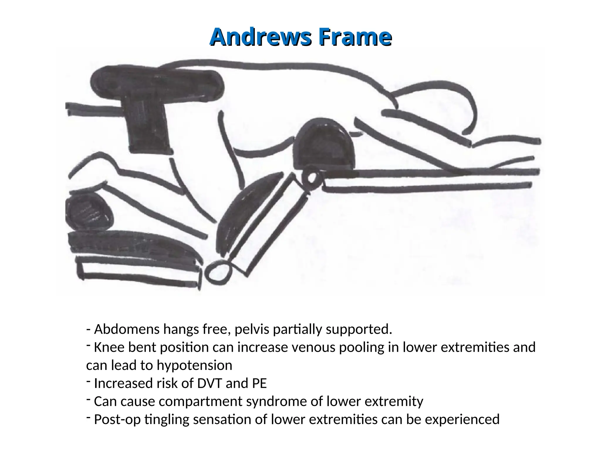 Patient Positioning.ppt in neurosurgery operations in theatre | PPT