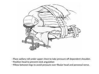 Patient Positioning.ppt in neurosurgery operations in theatre | PPT