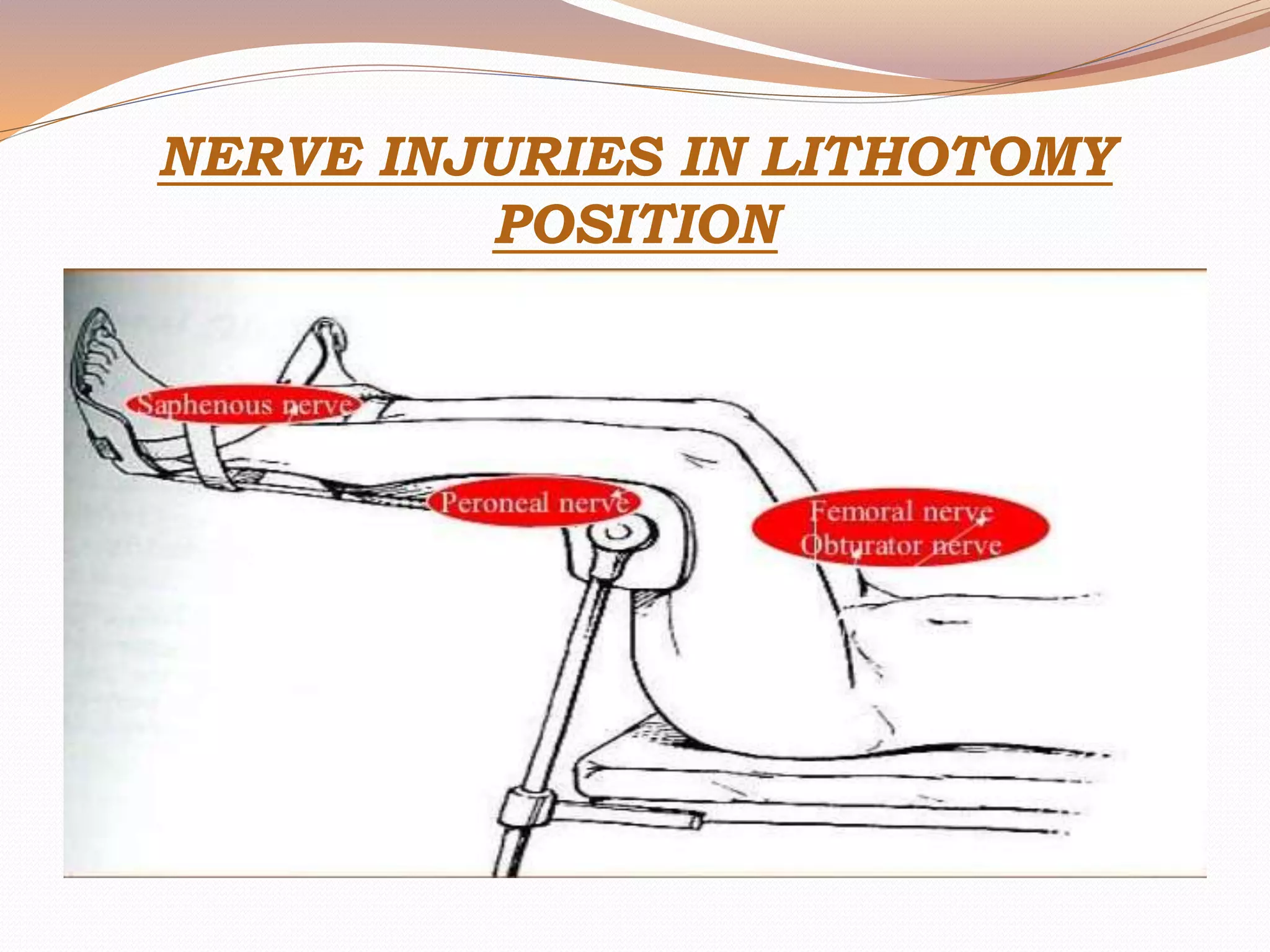 Patient positioning and anaesthetic consideration | PPTX