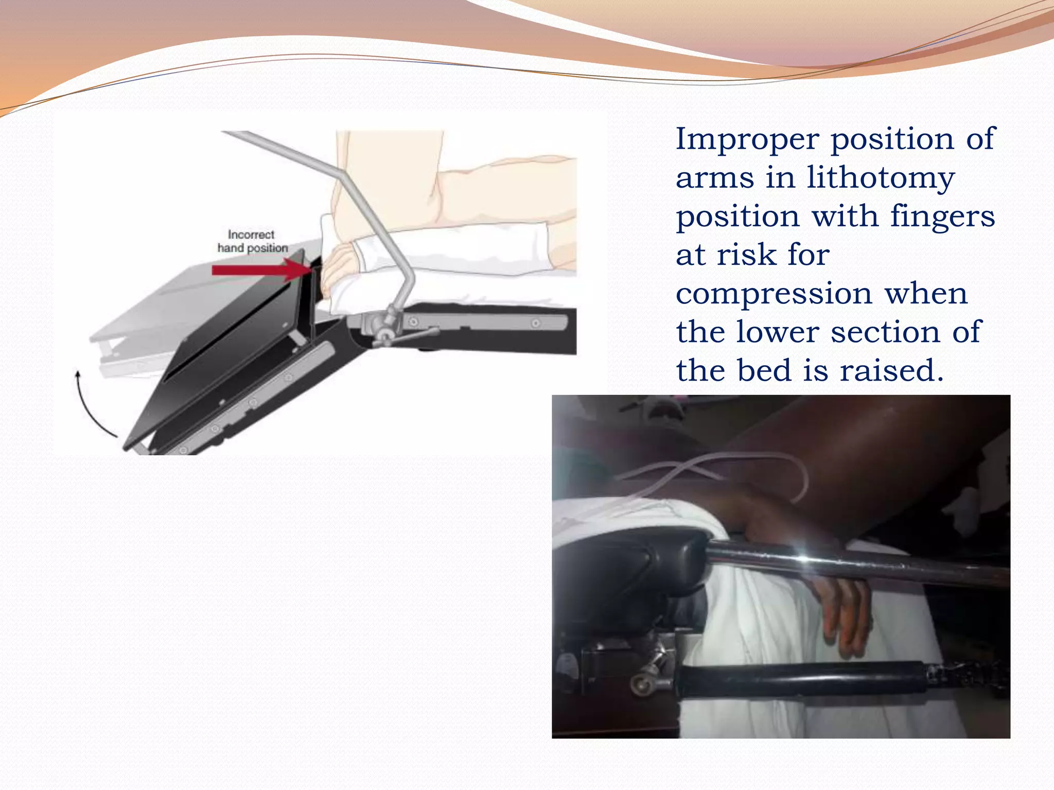 Patient positioning and anaesthetic consideration | PPTX