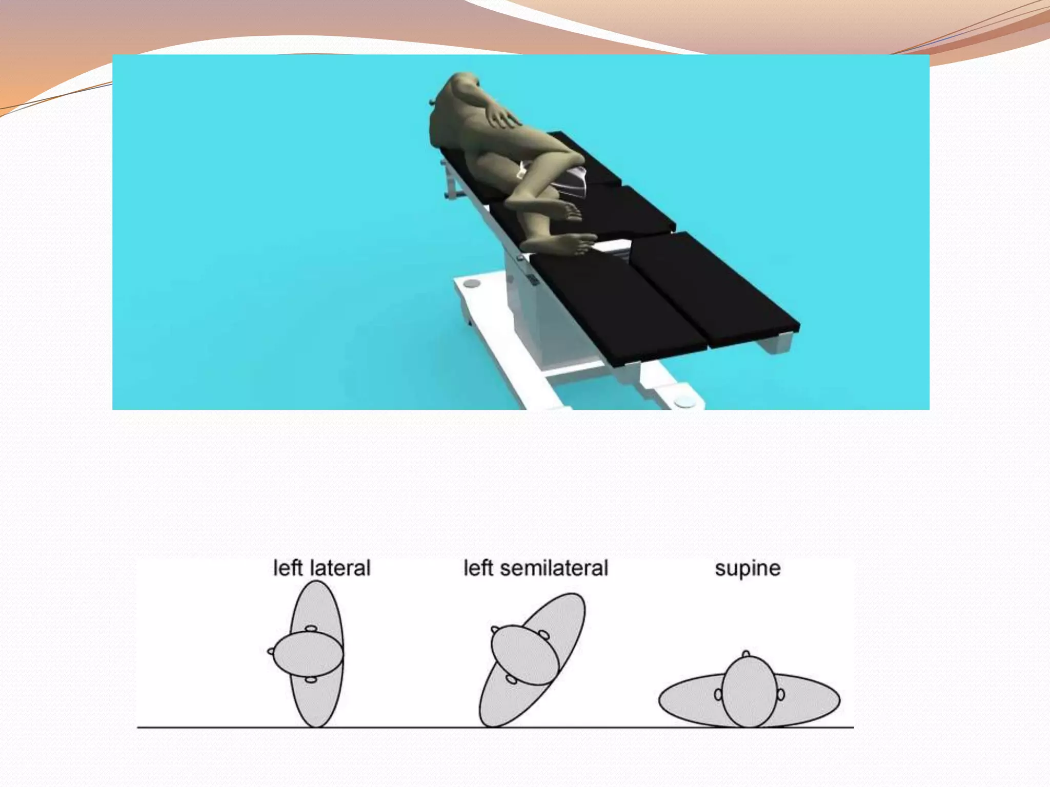Patient positioning and anaesthetic consideration | PPTX