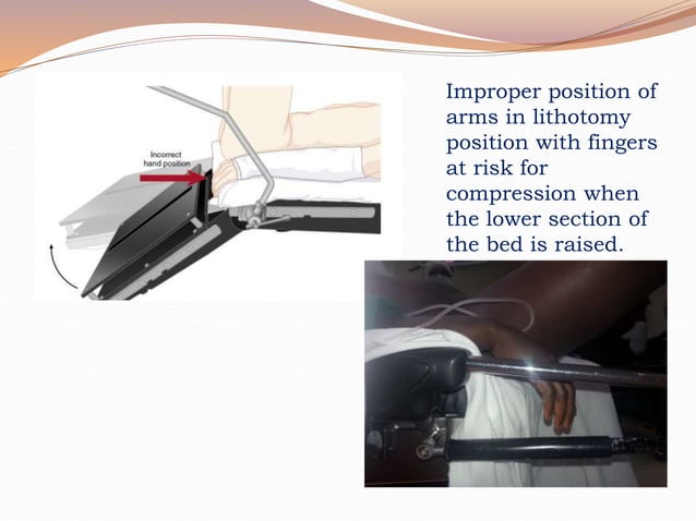 Patient positioning and anaesthetic consideration | PPTX