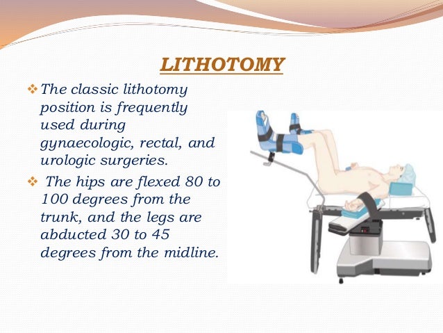 Patient positioning and anaesthetic consideration