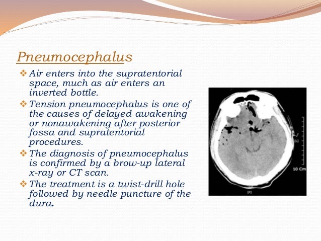 Patient positioning and anaesthetic consideration