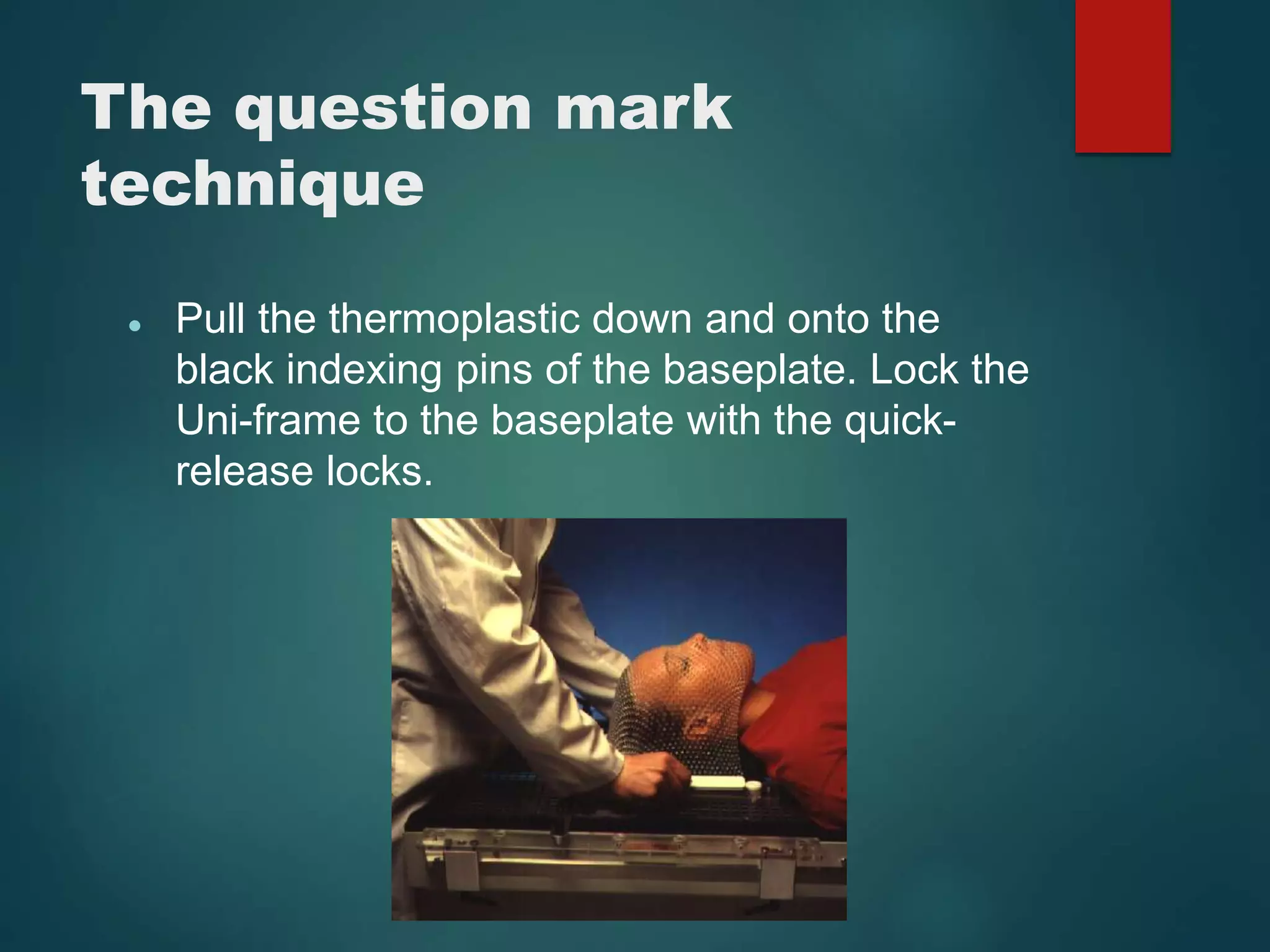 Patient Positioning and Immobilization Devices In Radiotherapy Planning ...